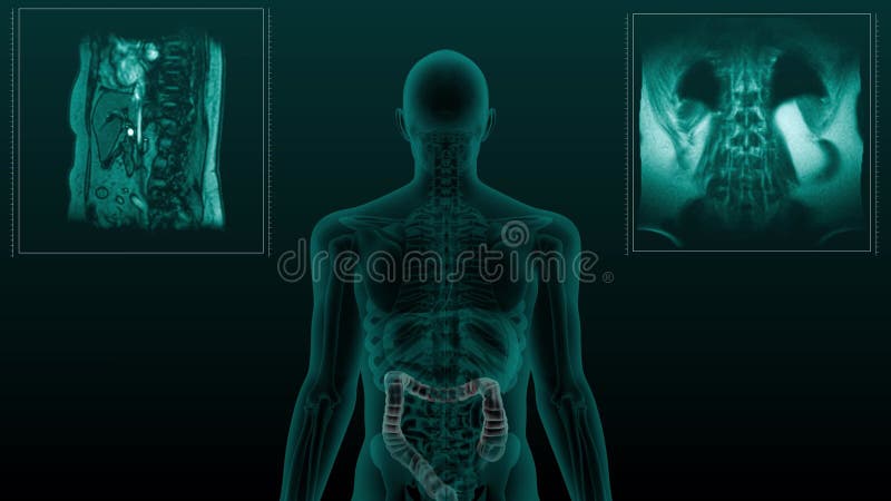 Magnetic Resonance Tomography Scan of the Human Digestive System ...
