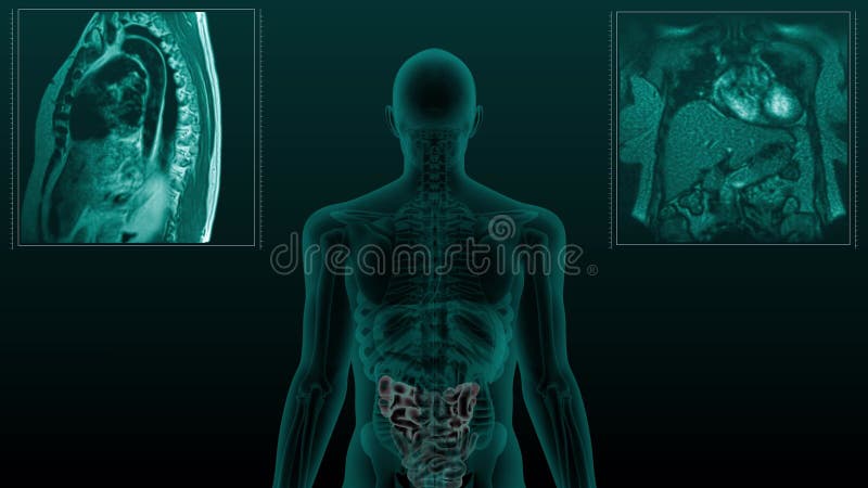 Magnetic Resonance Tomography Scan of the Human Digestive System ...