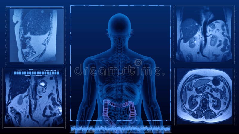 Magnetic Resonance Tomography Scan of the Human Digestive System. 3d ...