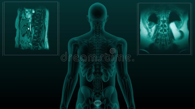 Magnetic Resonance Tomography Scan of the Human Urinary System. 3d ...
