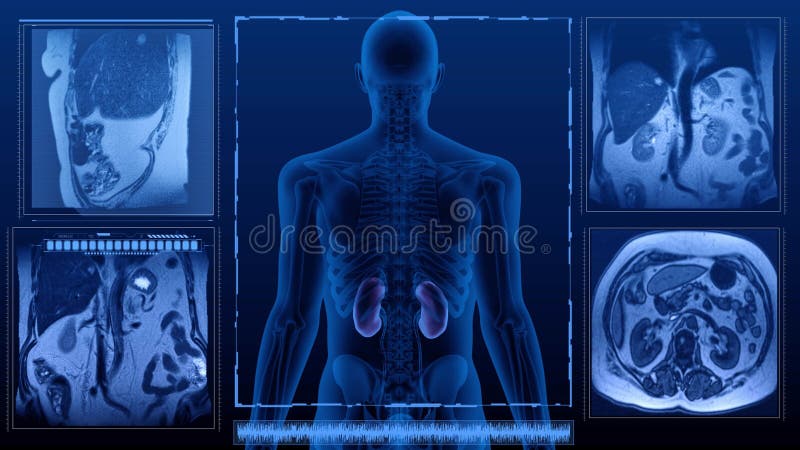 Magnetic Resonance Tomography Scan of the Human Urinary System. 3d ...