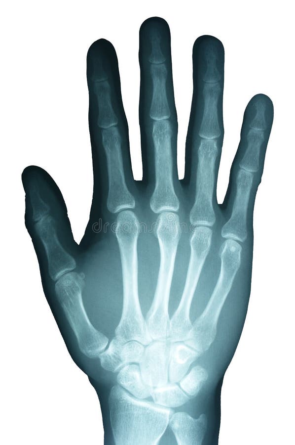 Main droite image stock. Image du hôpital, médical, blanc - 27991793