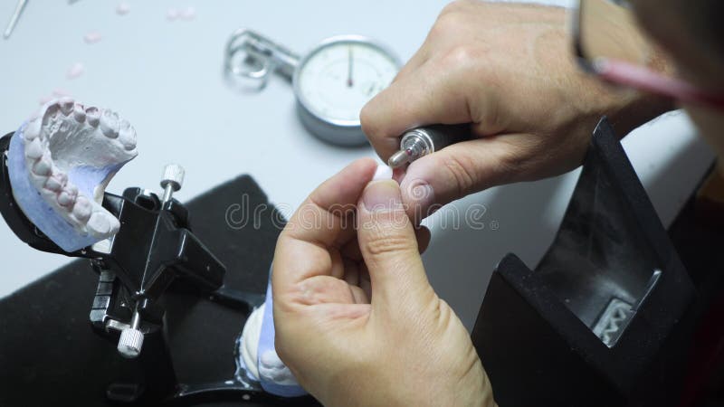 Making a Dental Crown. Laboratory Stock Video - Video of analyzing ...