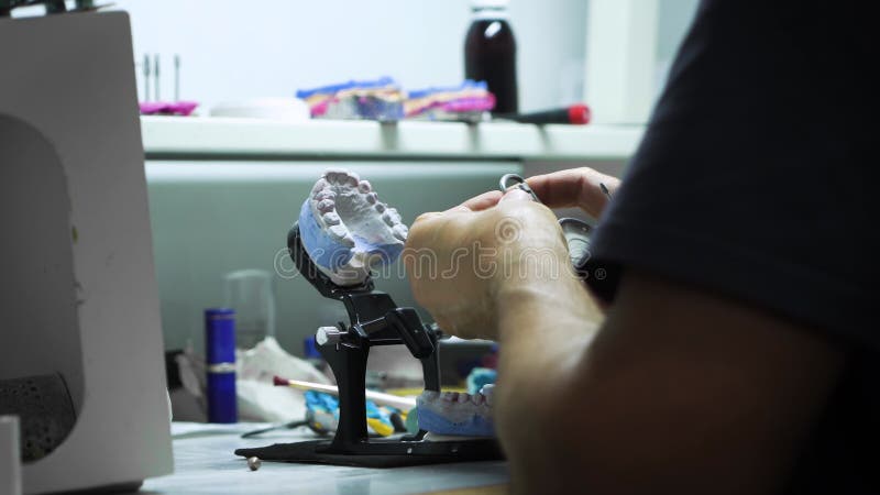 Making a Dental Crown. Laboratory Stock Video - Video of medicine ...