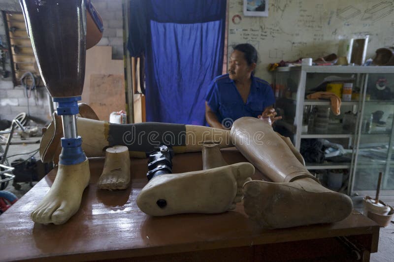 Making prosthetic editorial stock photo. Image of city - 75575868