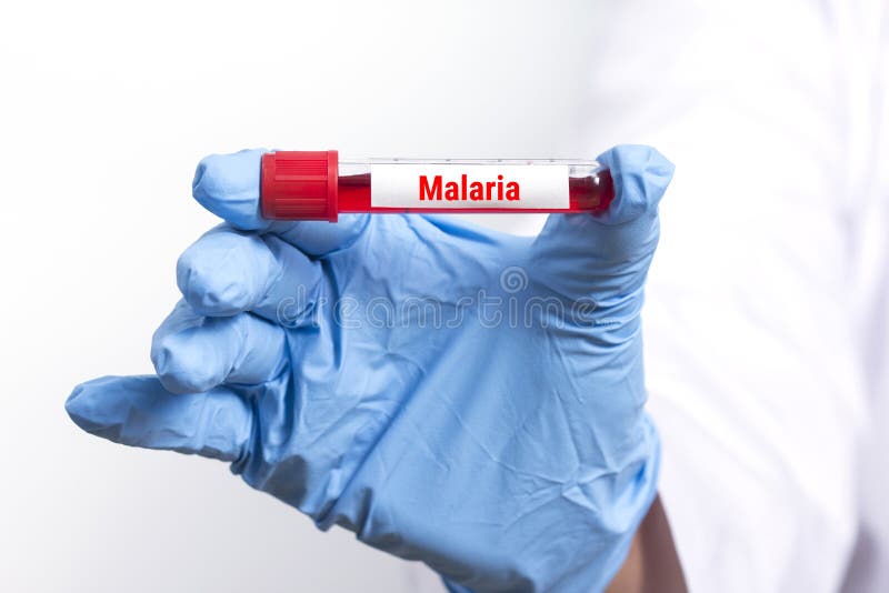 Malaria blood test stock photo. Image of human, balabacensis - 71028008