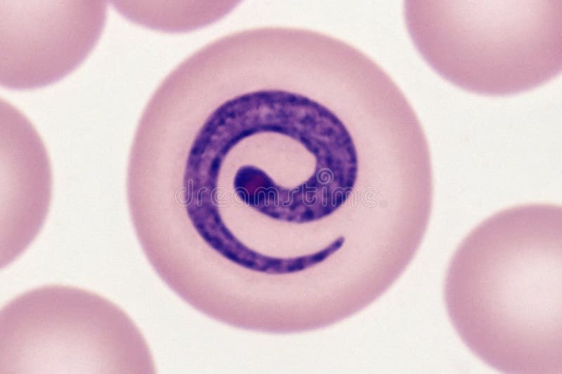 Malaria Parasite Inside Red Blood Cell Under Microscope – Medical ...