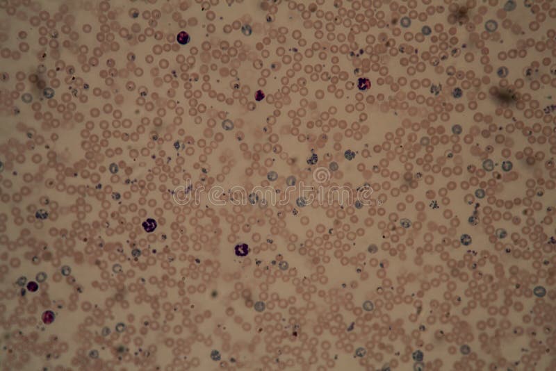 Plasmodium Under Microscope 400x