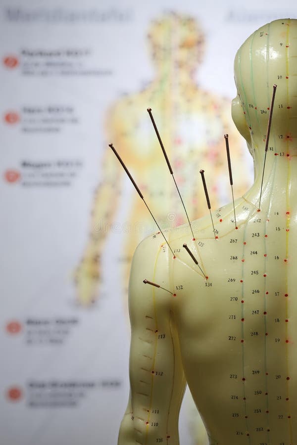 Male acupuncture model stock image. Image of naturopathy - 204655495