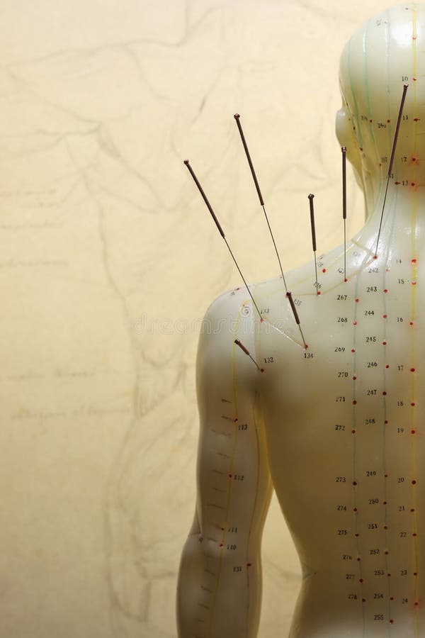 Male acupuncture model stock photo. Image of care, healthcare - 204655630