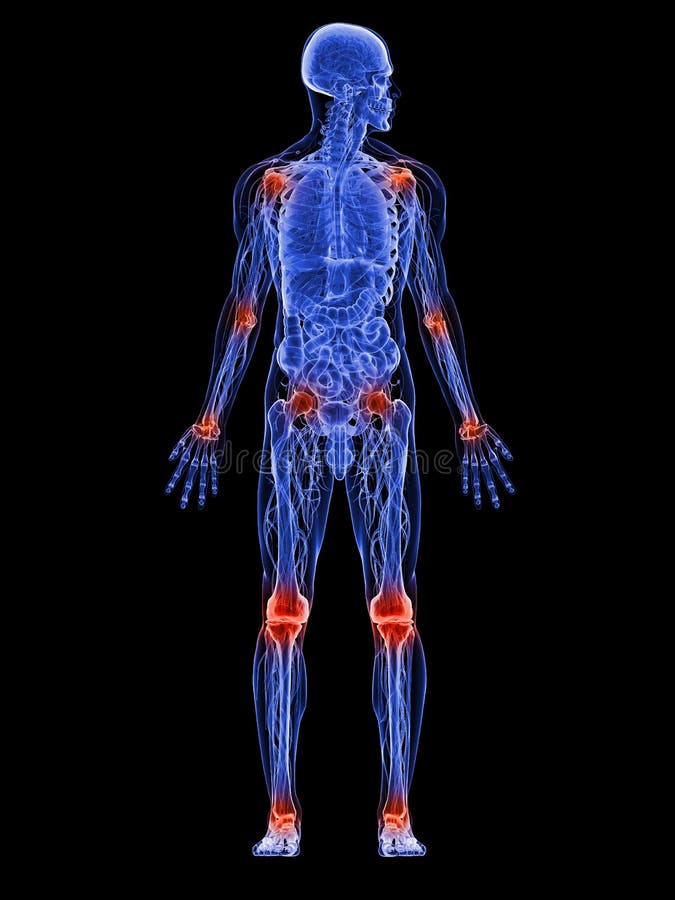 Male body with joint pain stock illustration. Illustration of bones ...