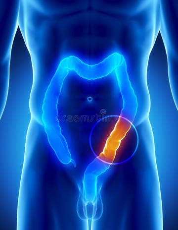 Male COLON Problem - Digestive System Stock Illustration - Illustration ...