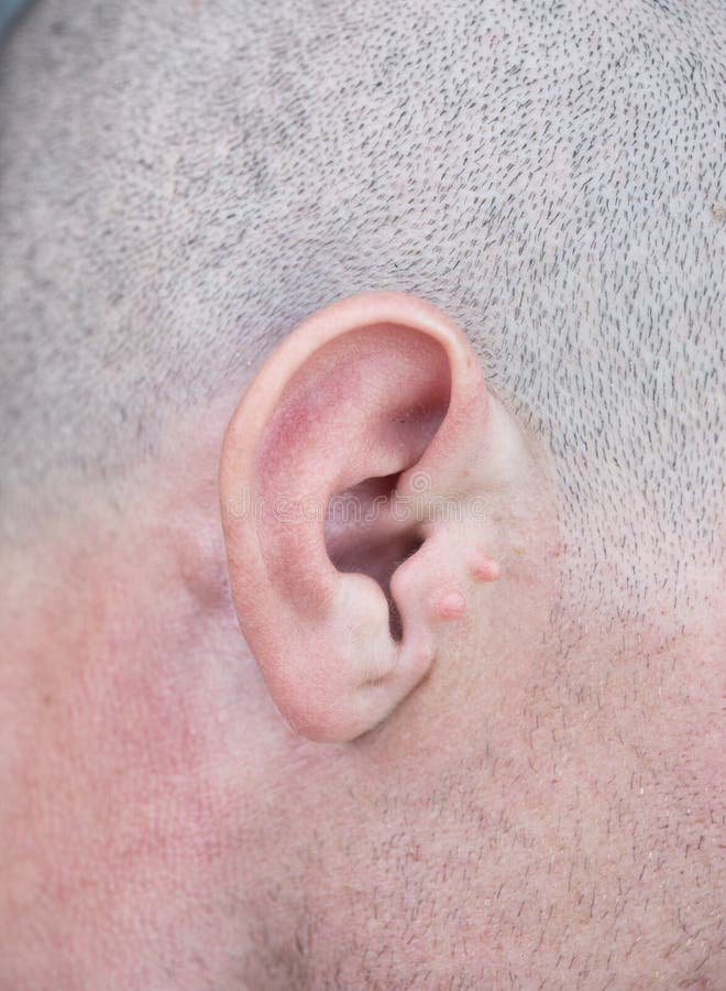 Male ear stock image. Image of perception, healthy, human - 44103615