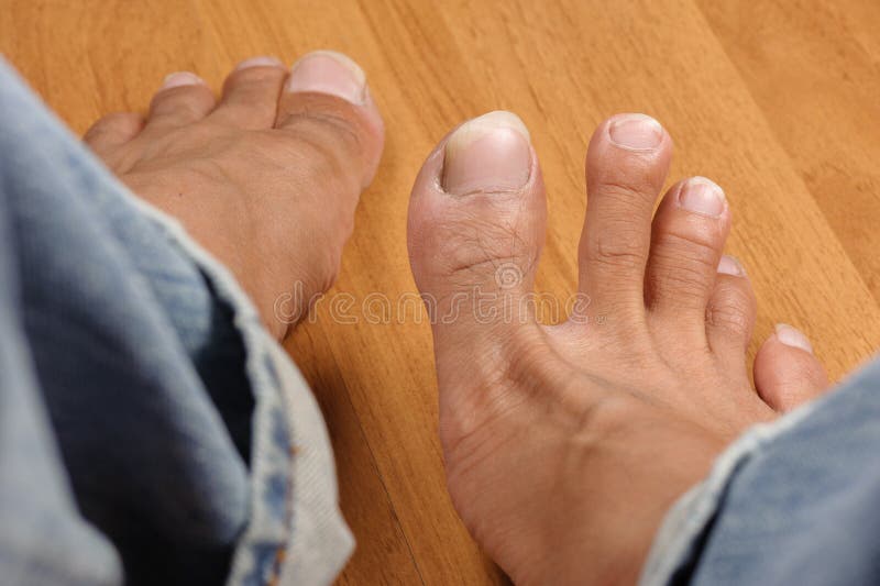 Male foot and toenail stock photo. Image of care, barefoot - 187173418