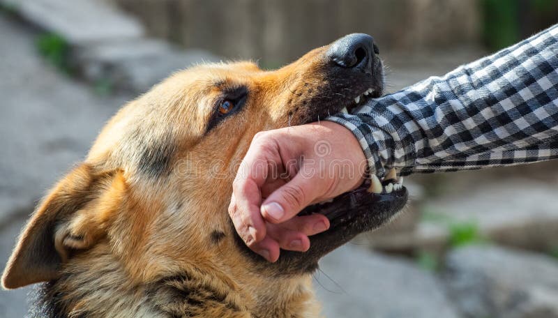 Dog Bites On Hand