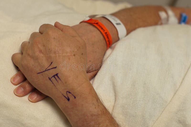 Male Hand Marked for Hand Operation. Stock Photo - Image of precaution ...