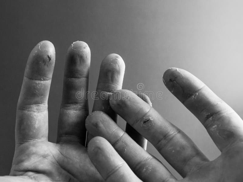 Maltreated hands stock image. Image of gray, hands, finger - 90724731