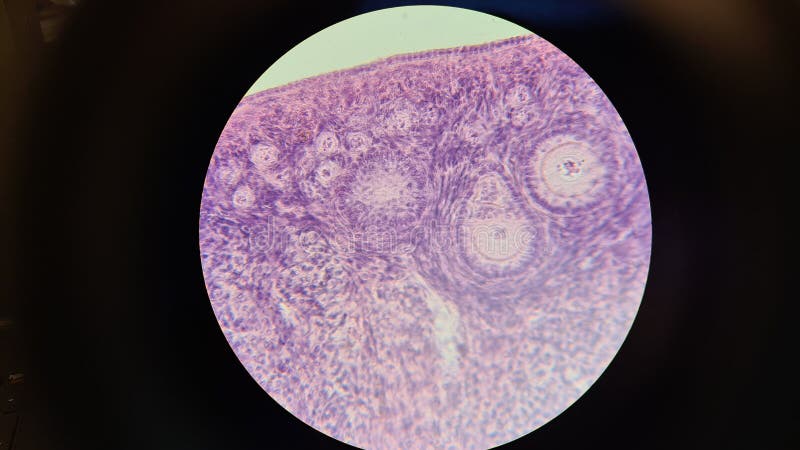 Mammalian Ovary Under a Microscope Stock Photo - Image of follicles ...