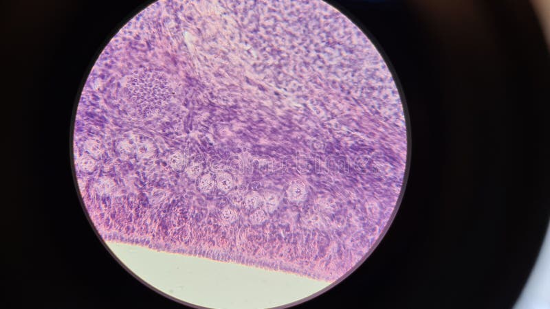 Mammalian Ovary Under a Microscope Stock Photo - Image of eosin ...