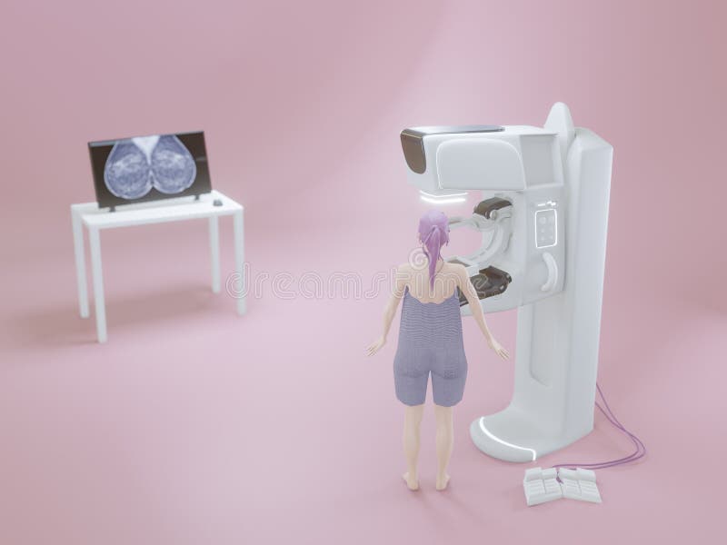 Mammography Device for Screening Breast Cancer 3D Woman Model . Stock ...