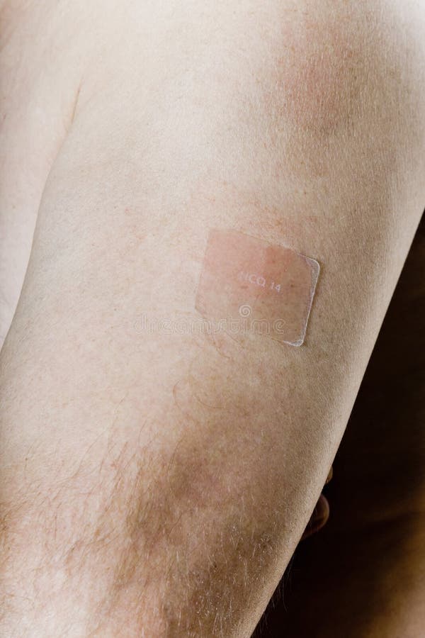 Man Arm with Nicotine Patch Stock Image - Image of healthcare, white ...