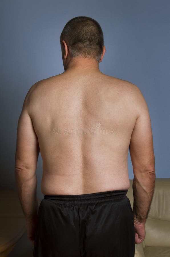 Man from the back. stock photo. Image of medical, physiotherapy - 48423630