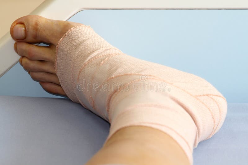 Man with bandaged leg stock photo. Image of ankle, closeup - 120727442