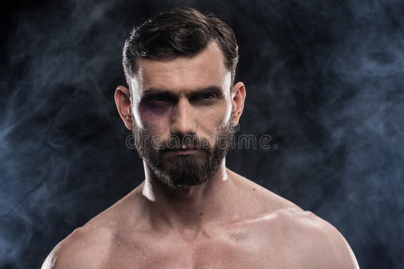 Man with black eye stock image. Image of sporting, exercise - 90343463