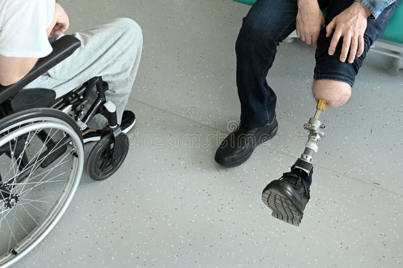 A Man with Bone-implanted Leg Prostheses. Osteointegration Stock Image ...