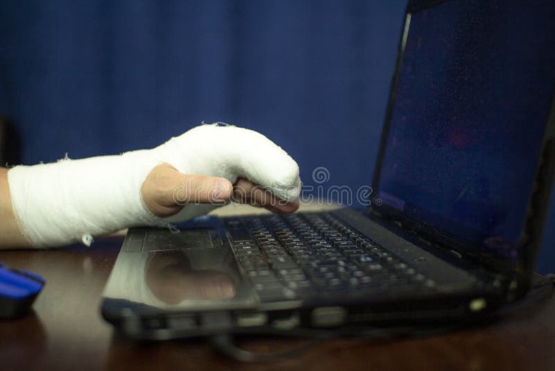 A Man with a Cast on His Arm is Working at a Computer Stock Photo ...
