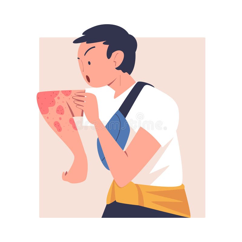 Itching Person Skin Stock Illustrations – 149 Itching Person Skin Stock ...