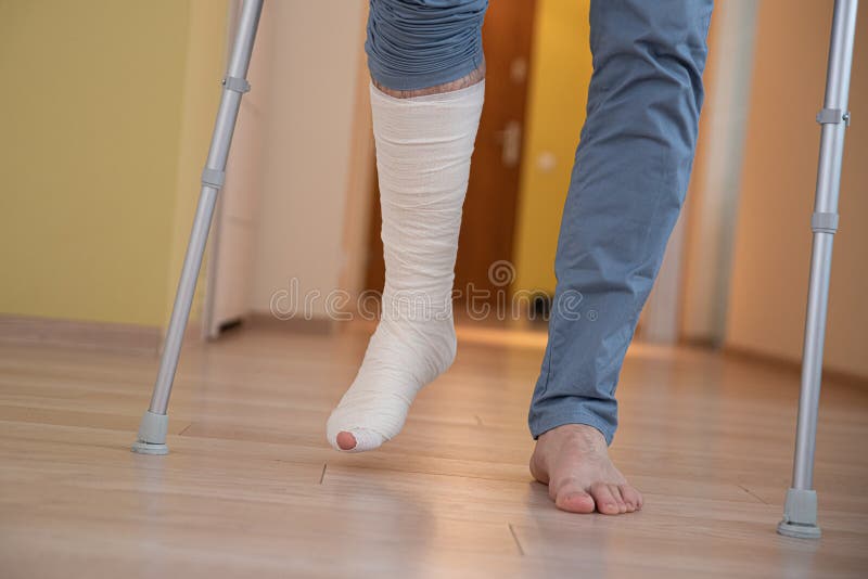 A Man on Crutches. Young Man with a Broken Leg Stock Image - Image of ...