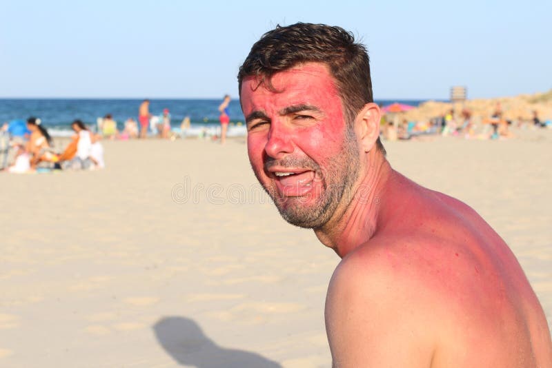Man Crying after a Long Sun Exposure Stock Image - Image of careless ...
