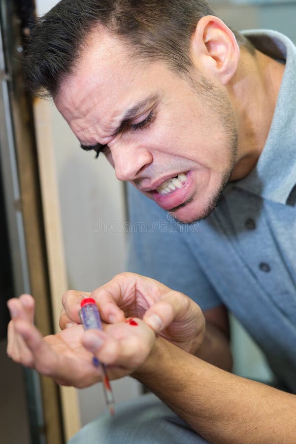 Man cut hand at work stock image. Image of tape, splatter - 271545057