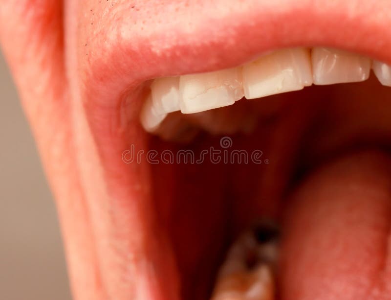 Man with Small Chips on His Two Front Teeth Stock Image - Image of ...