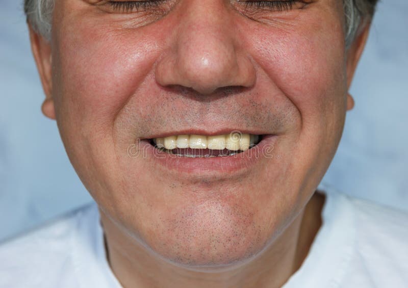 Black Man Smiling With No Teeth