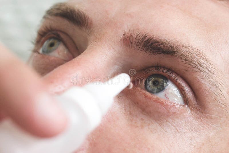 Man Drops Eye Drops Install Lenses Stock Image - Image of eyeball, hold ...