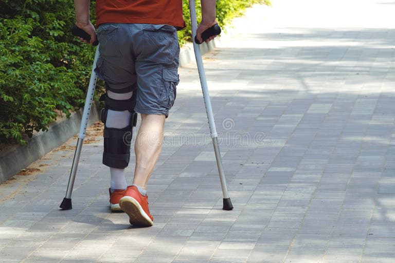 121 Man Knee Cast Stock Photos - Free & Royalty-Free Stock Photos from ...