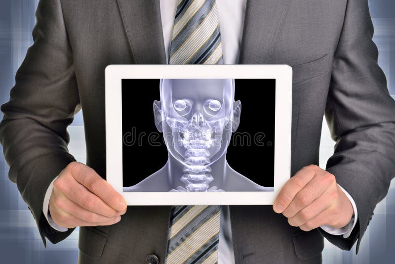 Man Hands Using Tablet Pc. Image of X-ray Head on Stock Image - Image ...