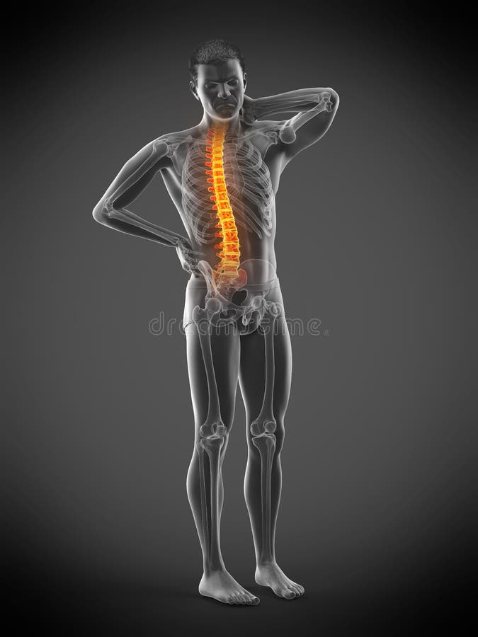 A man having a backache stock illustration. Illustration of inflamed ...