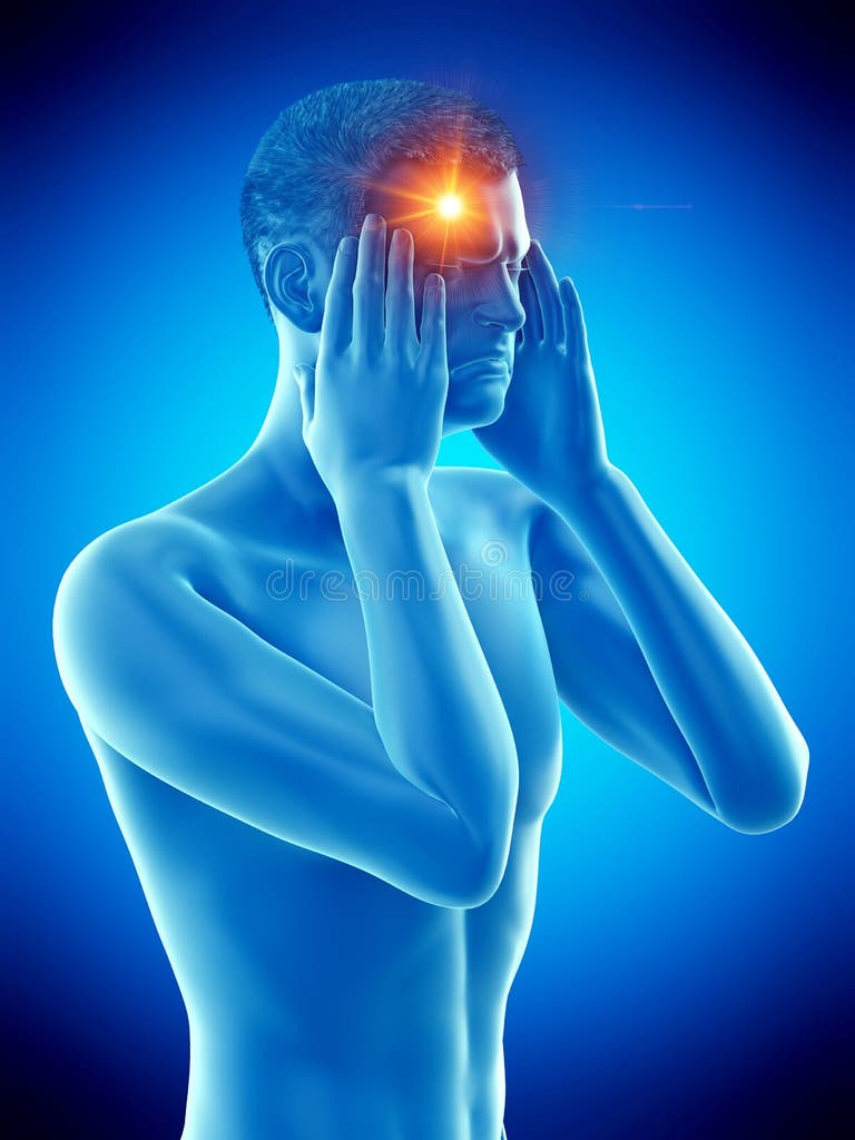 Headache Stock Illustrations – 53,774 Headache Stock Illustrations ...
