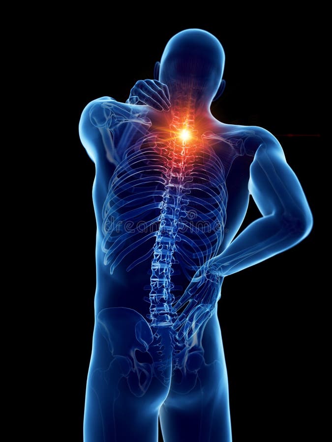Painful back stock illustration. Illustration of pain - 4129579