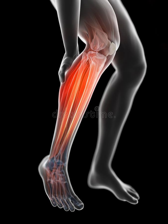 Calf pain stock illustration. Illustration of medically - 74189334