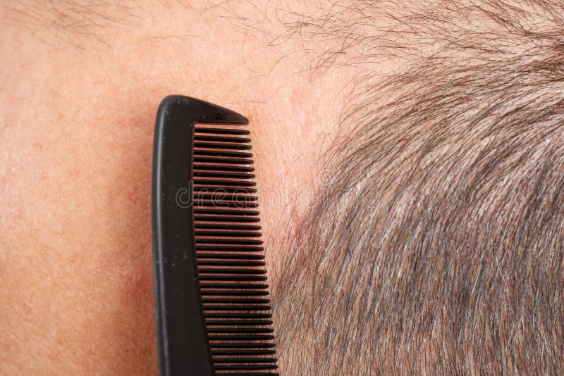 Man head with a comb. stock image. Image of nape, loss - 89937081