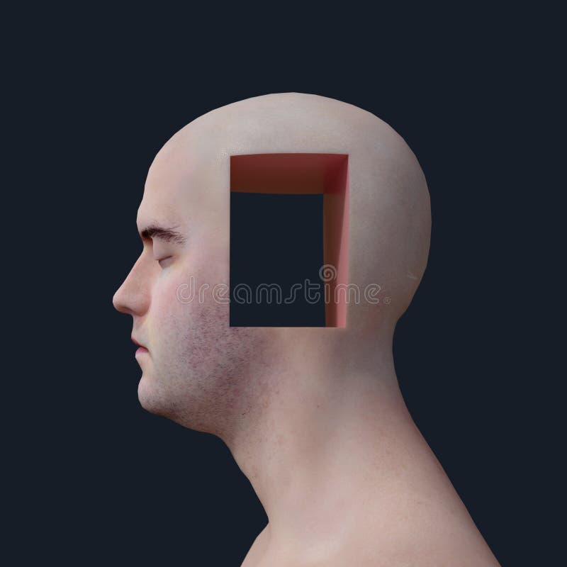 Man with a Hole in His Head Stock Illustration - Illustration of ...