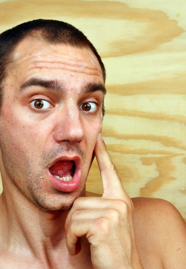 Man with Infected Skin on the Face Stock Image - Image of epidemic ...