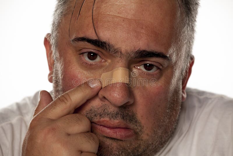 Man with injured nose stock image. Image of nose, broken - 87079917