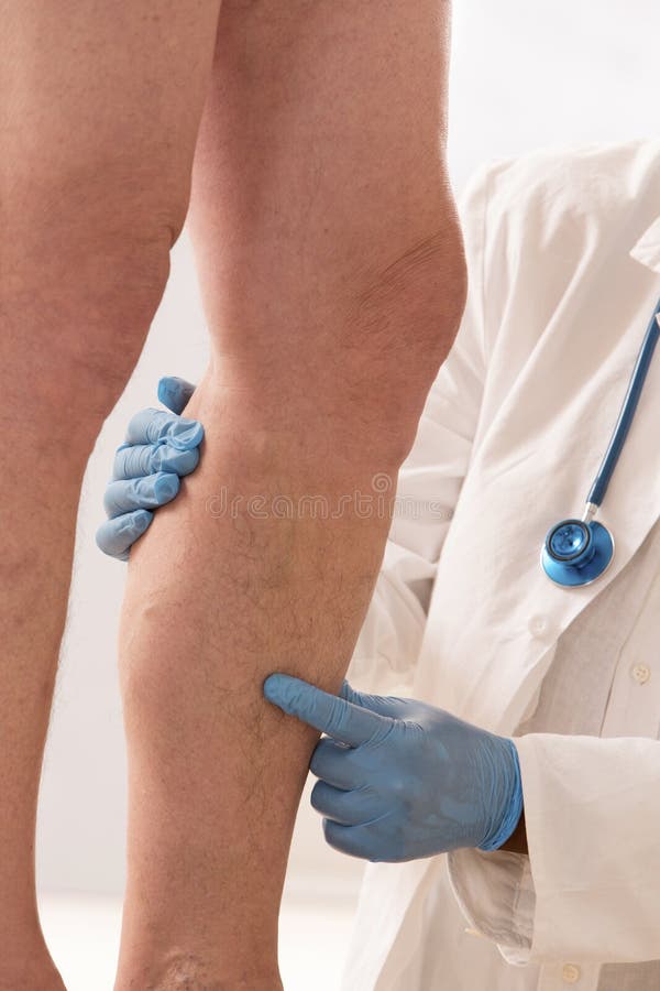 Man Lower Limb Vascular Examination by Phlebologist Stock Photo - Image ...