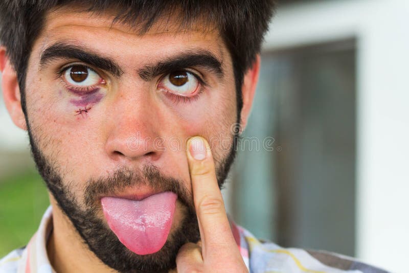 Man Making Faces while Being Hurt Stock Image - Image of attitude ...