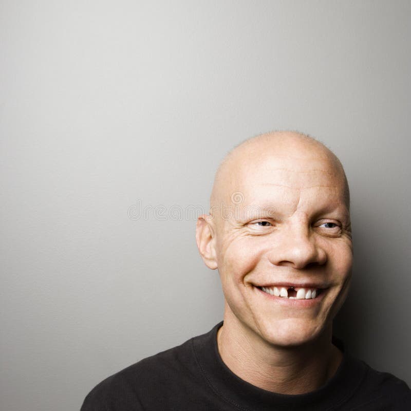 Man with missing tooth. stock photo. Image of image, copy - 2846364